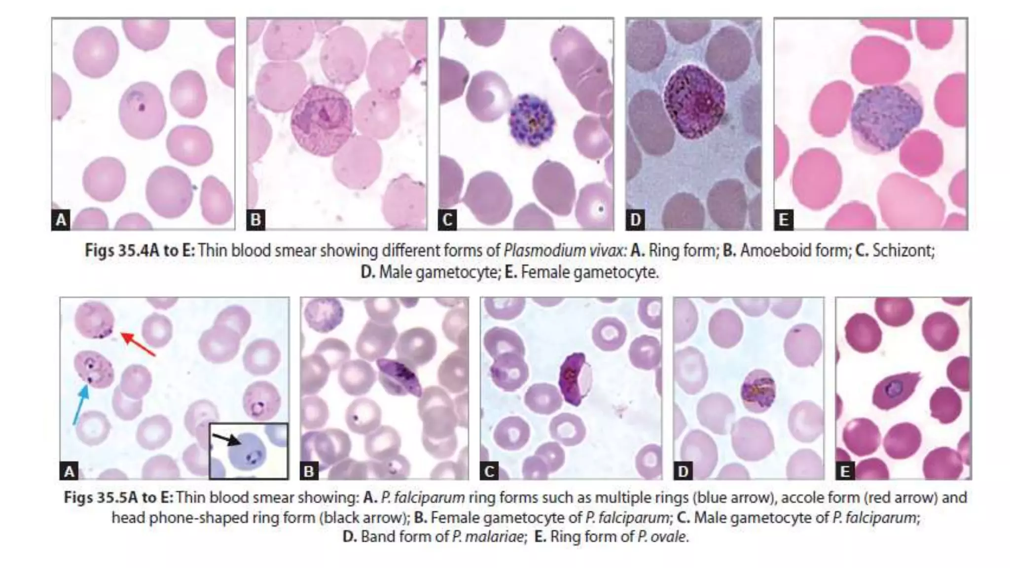 malaria - lab. diagnosis.pptx