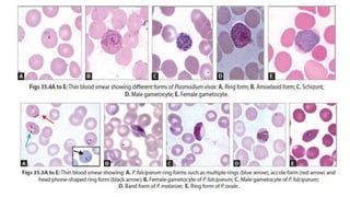 malaria - lab. diagnosis.pptx
