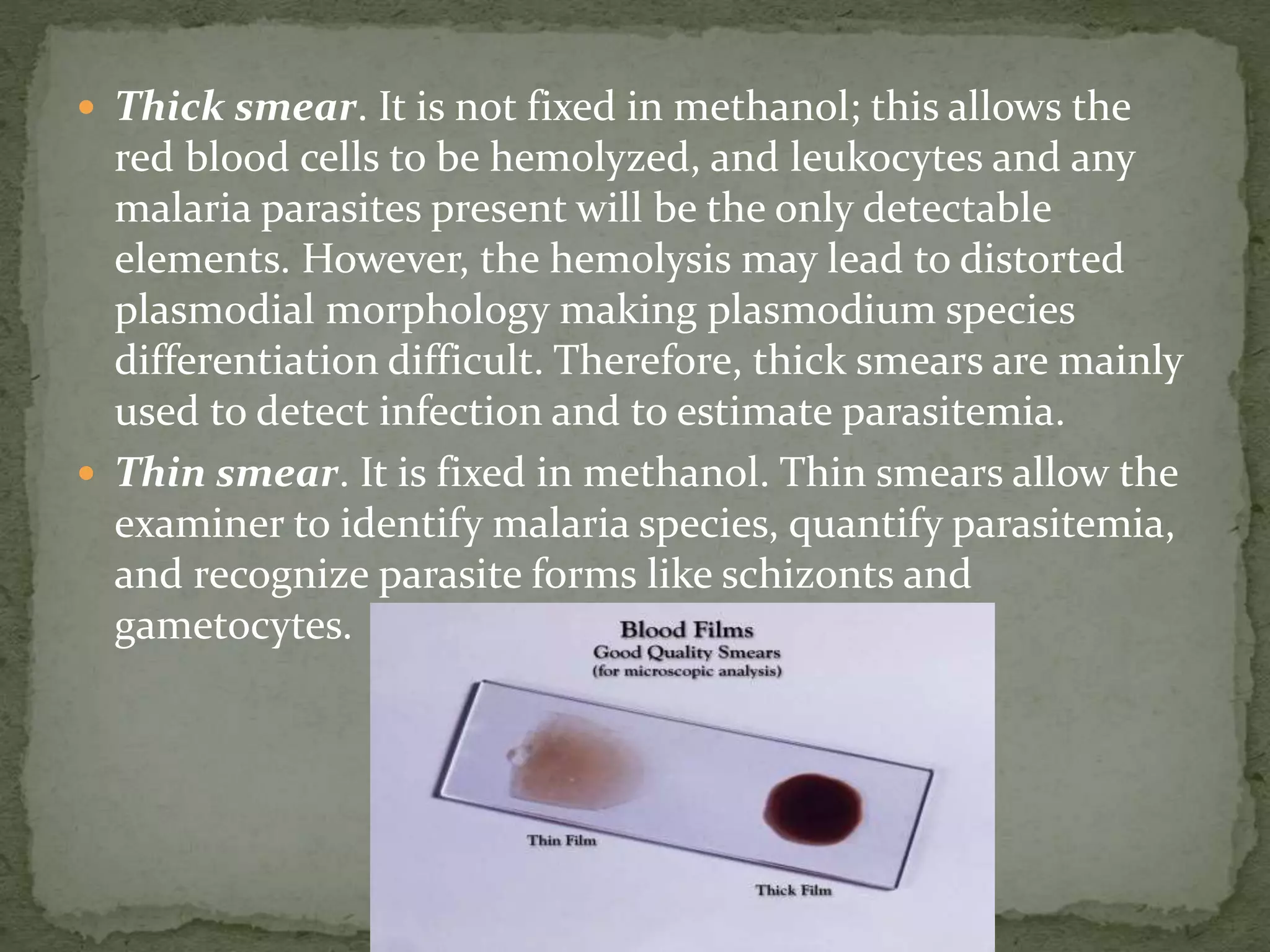 Malaria laboratory diagnosis | PPTX