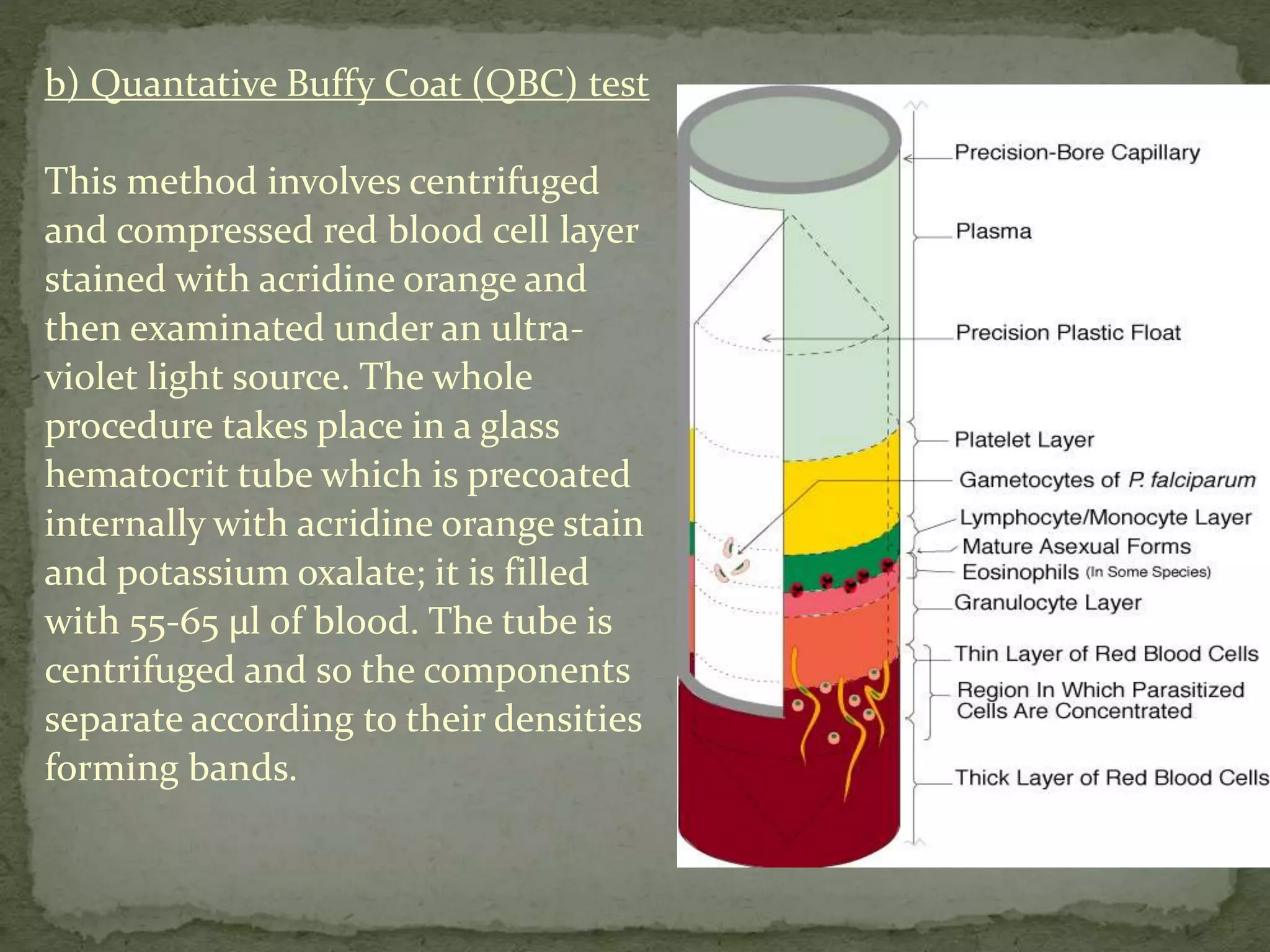 Malaria laboratory diagnosis | PPTX