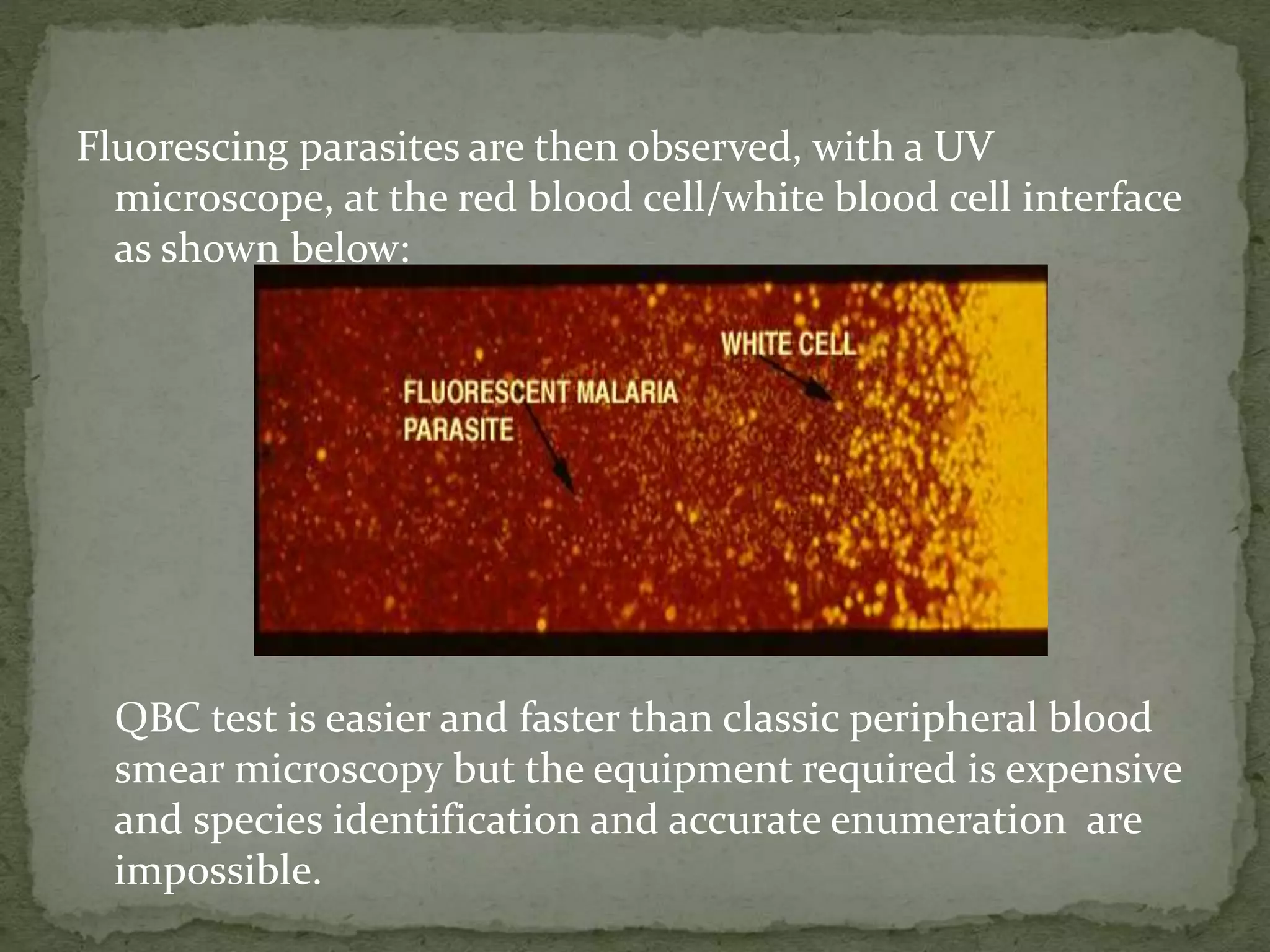 Malaria laboratory diagnosis | PPTX