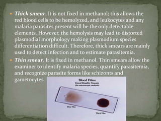 Malaria laboratory diagnosis | PPTX