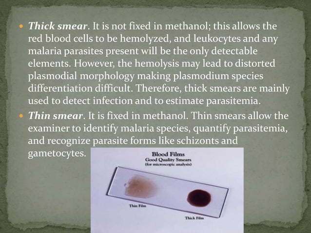 Malaria laboratory diagnosis | PPTX | Blood Disorders | Diseases and ...