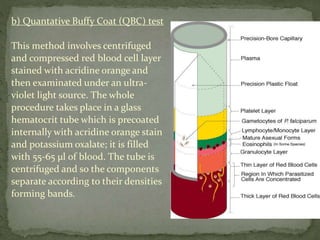 Malaria laboratory diagnosis | PPTX