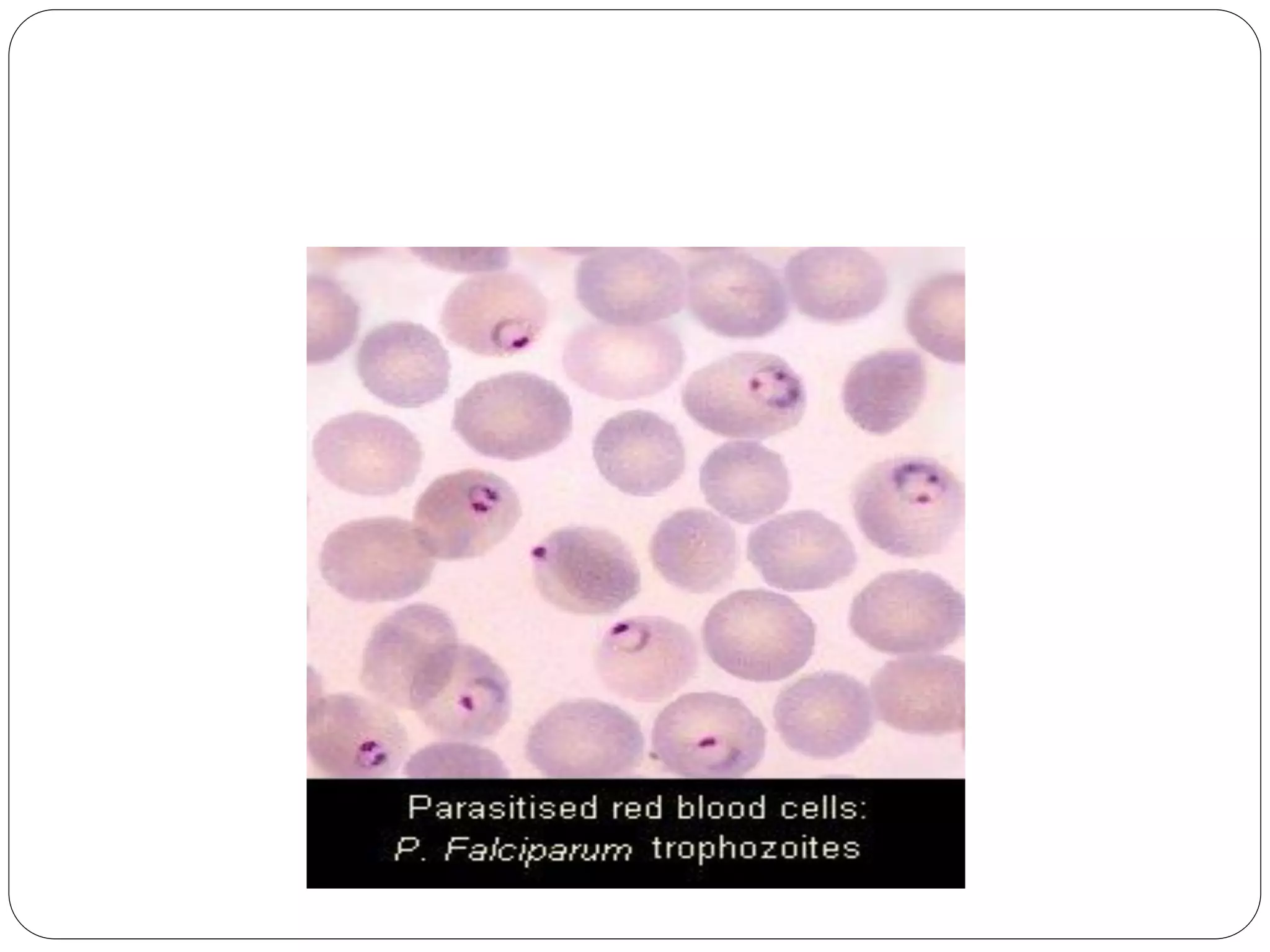 Malaria lecture 1 | PDF