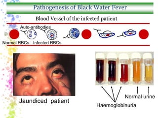 Malaria and bebesia | PPTX