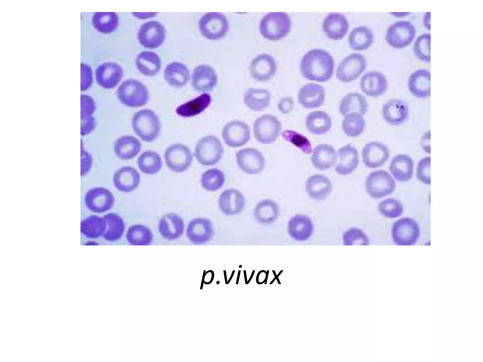 Malaria | PPT