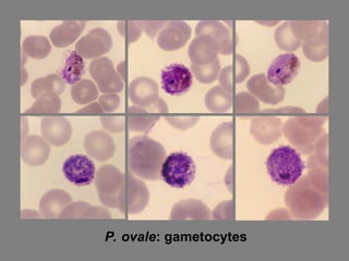 Diagnosis of Plasmodium species in thin and thick blood films | PPT