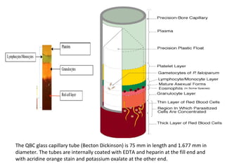 Malaria diagnosis methods | PPT