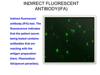 Malaria diagnosis methods | PPT