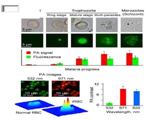 Malaria diagnosis methods | PPT