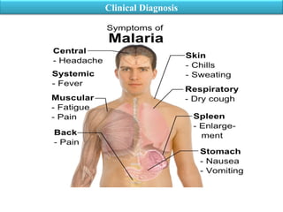 Malaria diagnosis methods | PPT