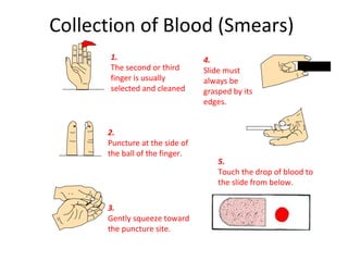 Malaria diagnosis methods | PPT