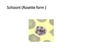 Malariae malaria | PPT