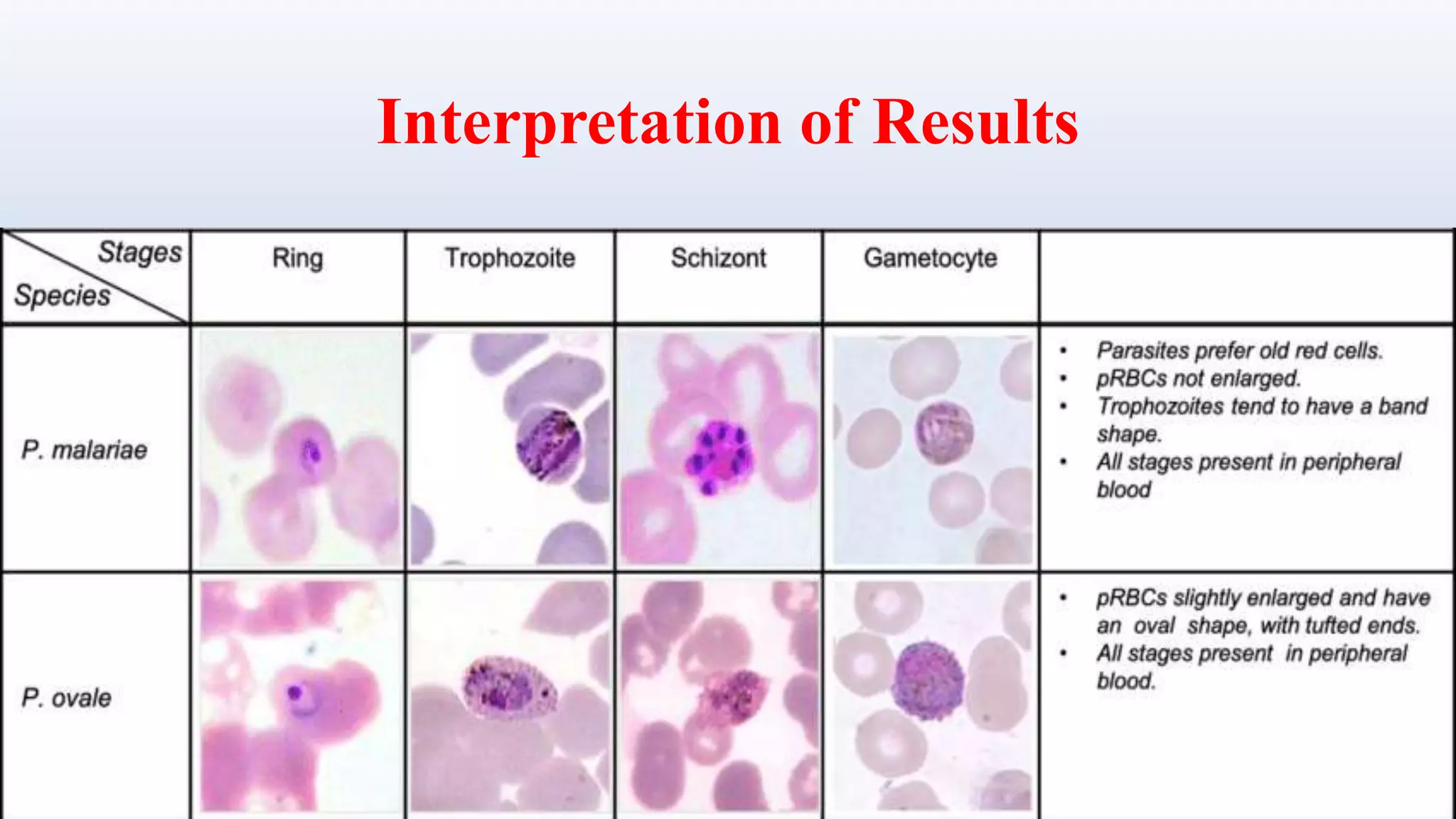 Malaria Identification in Laboratory.pptx