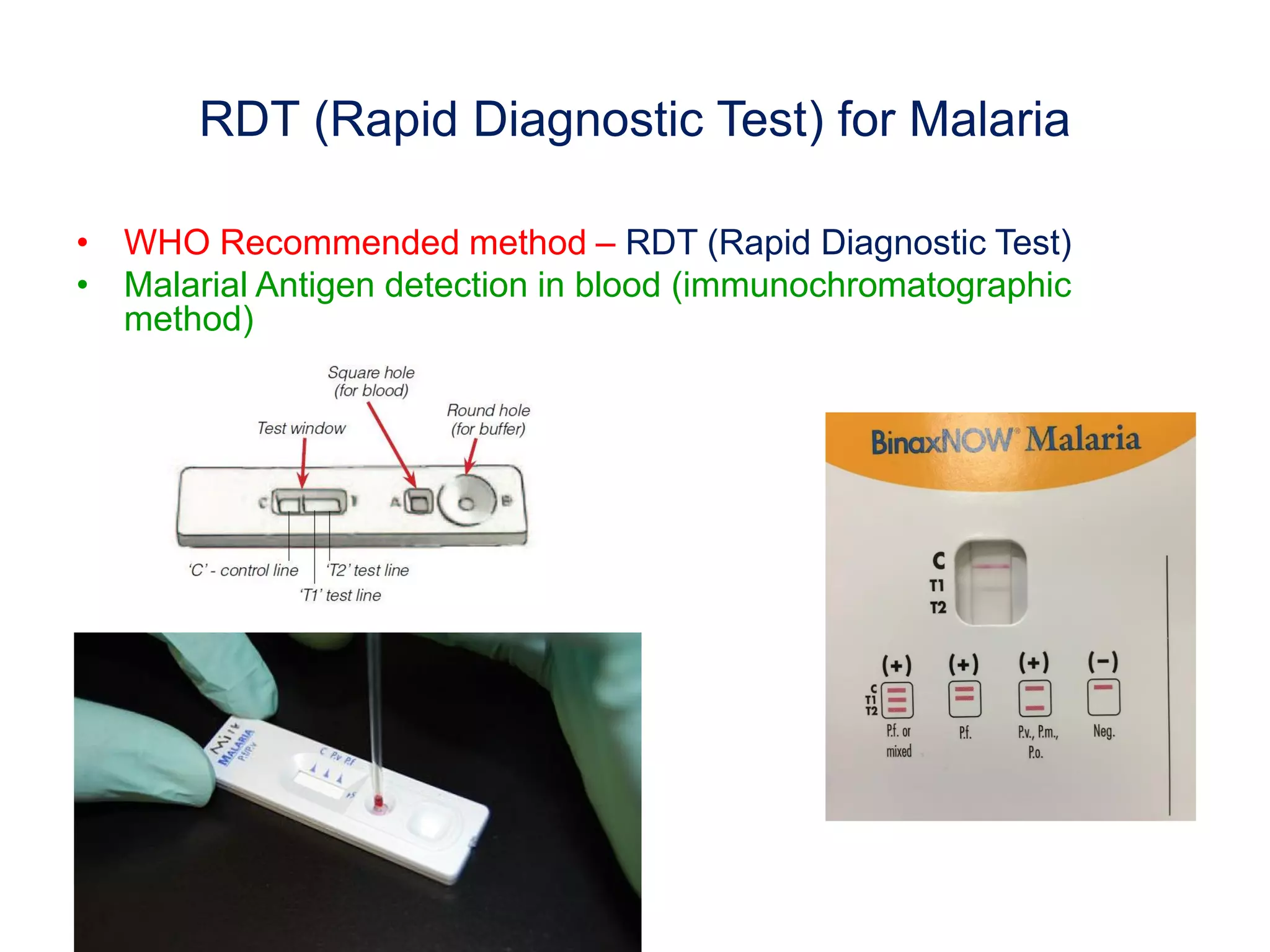 Malaria in children 2021 | PDF