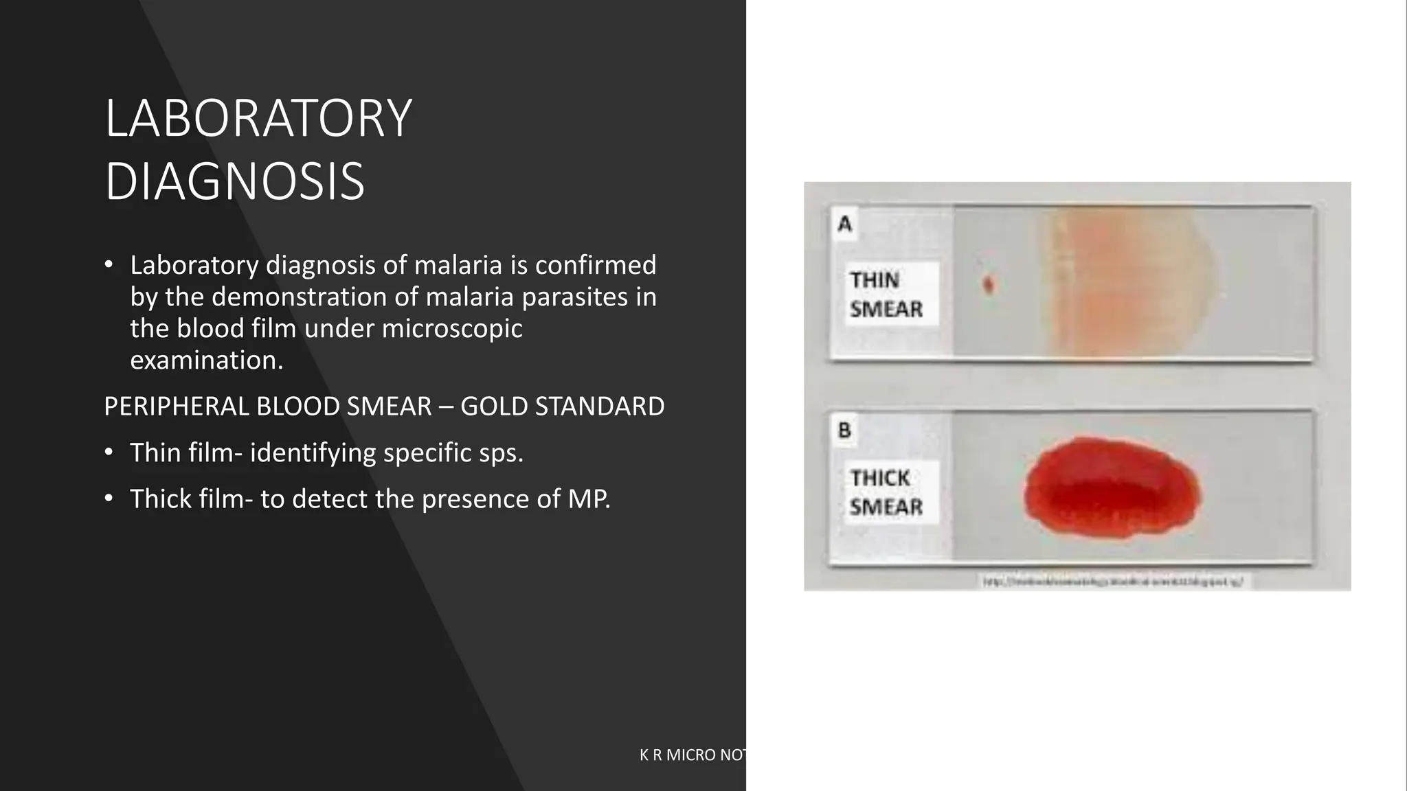 Malaria Medical Microbiology K R.pptx