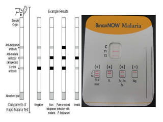 Malaria lab diagnosis | PPTX