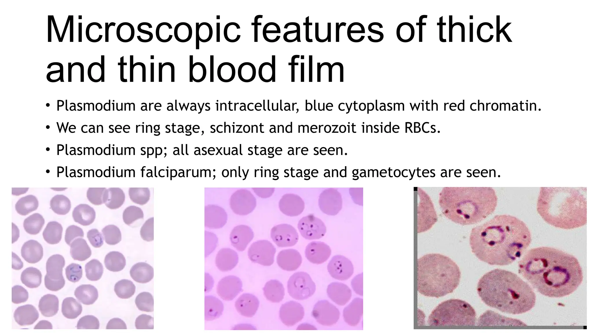 Malarial Parasite with causes and treatment | PPTX