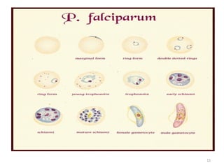 Malaria pediatric children Lecture.pptx