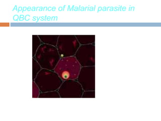 Malaria ppt | PPTX