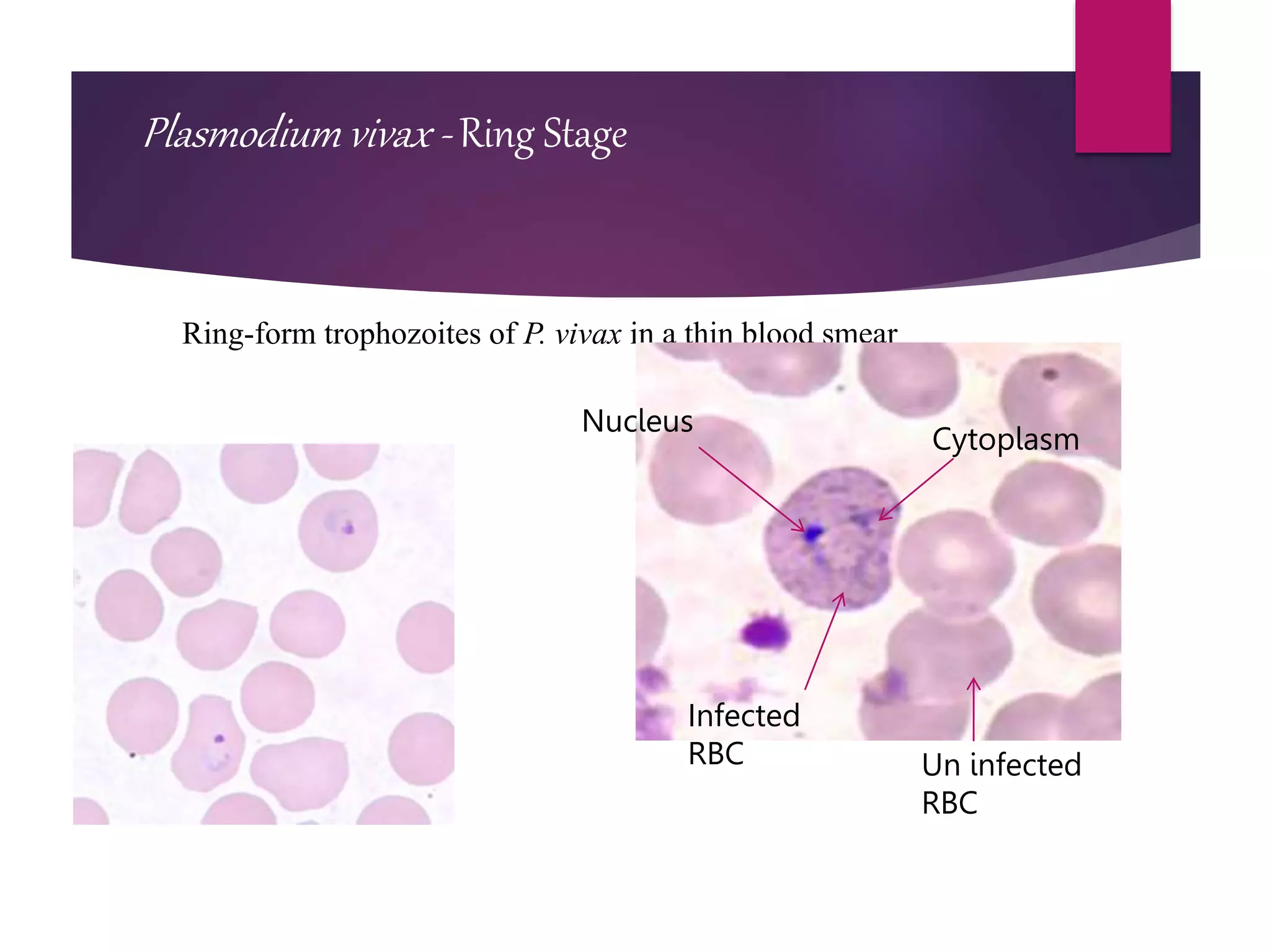 Malaria practical.pptx