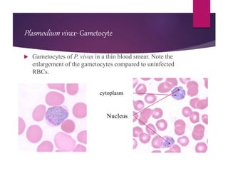 Malaria practical.pptx