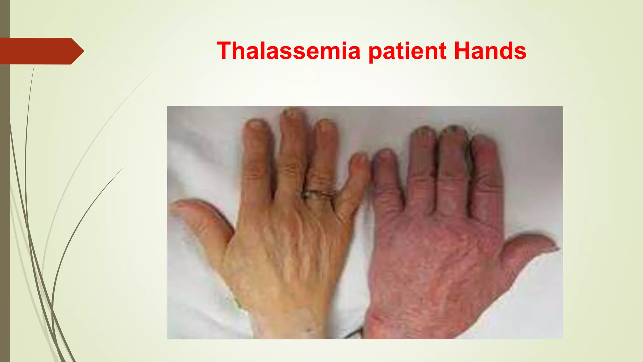 Malaria resistance " Resistance to Malaria" | PPT