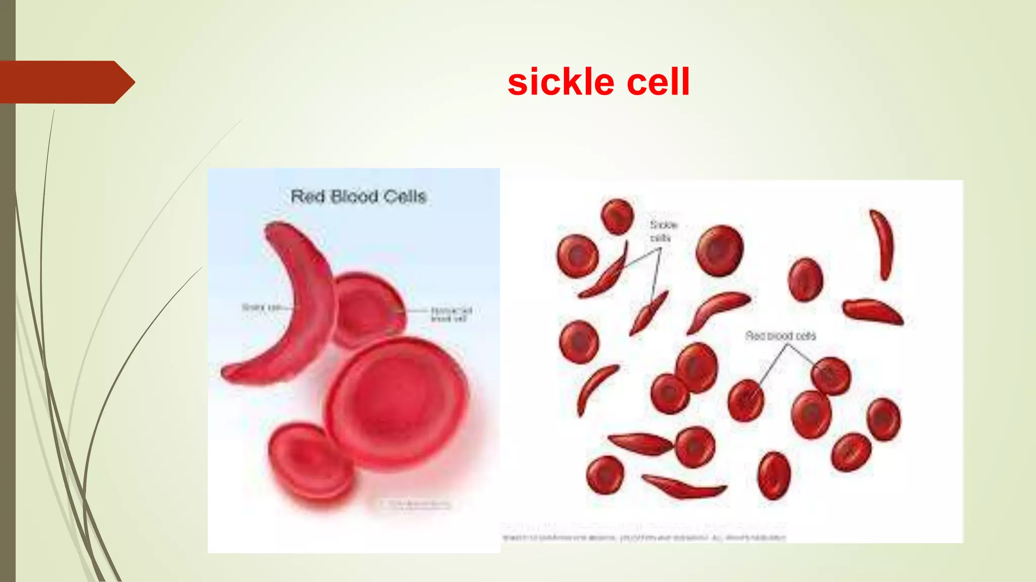 Malaria resistance " Resistance to Malaria" | PPT