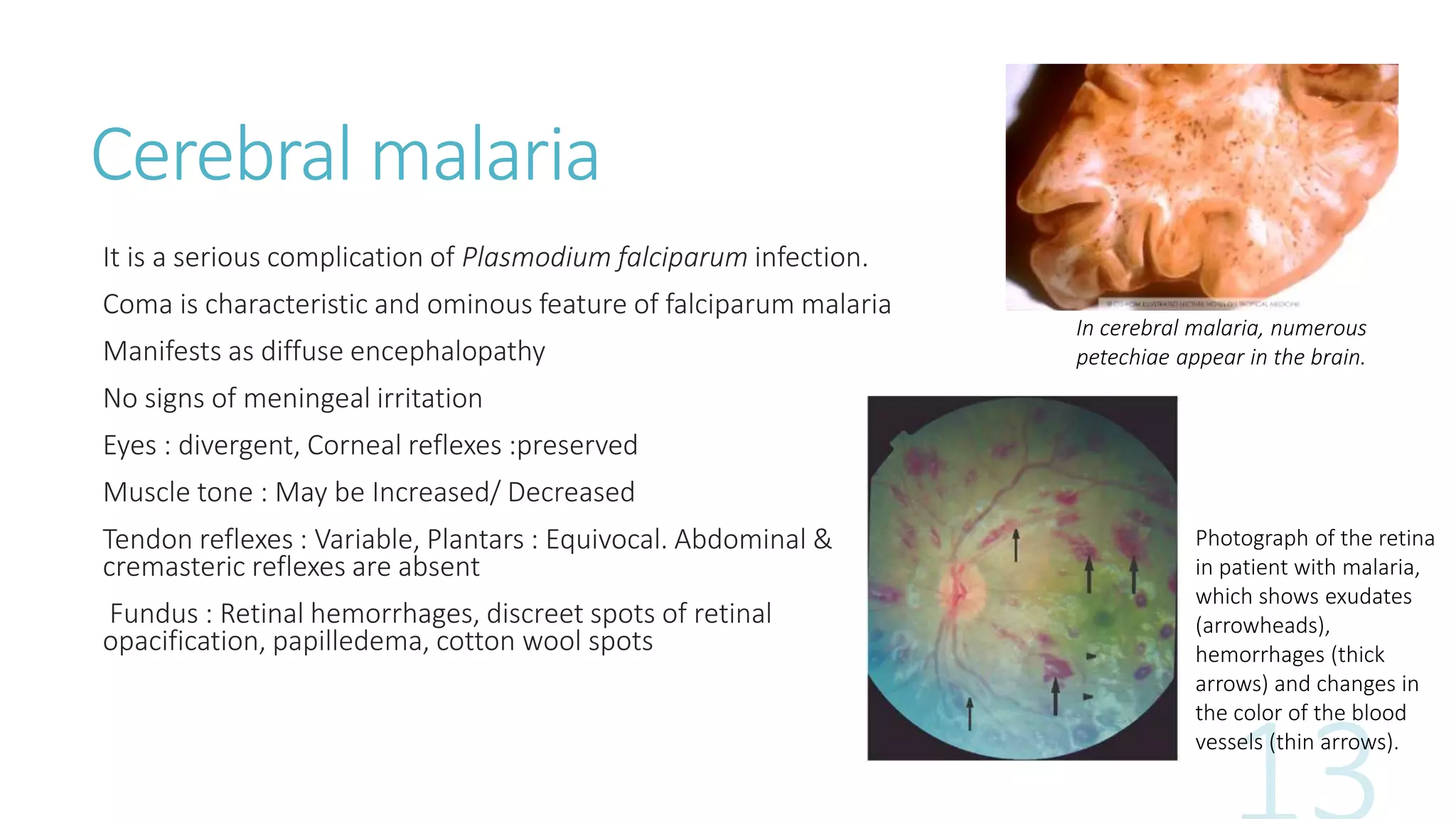 Malaria - Complications (Severe Malaria) | PPTX