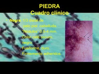 Malassezia | PPT
