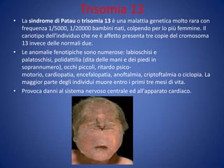 Malattie cromosomiche di simone | PPTX | Diseases and Conditions ...
