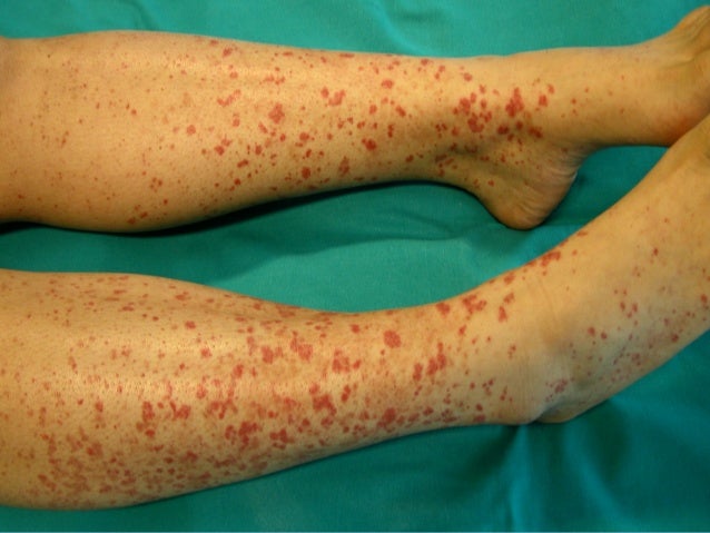 Malattie sistemiche e cute di Fausti Viglizo, Occella e Bleidl