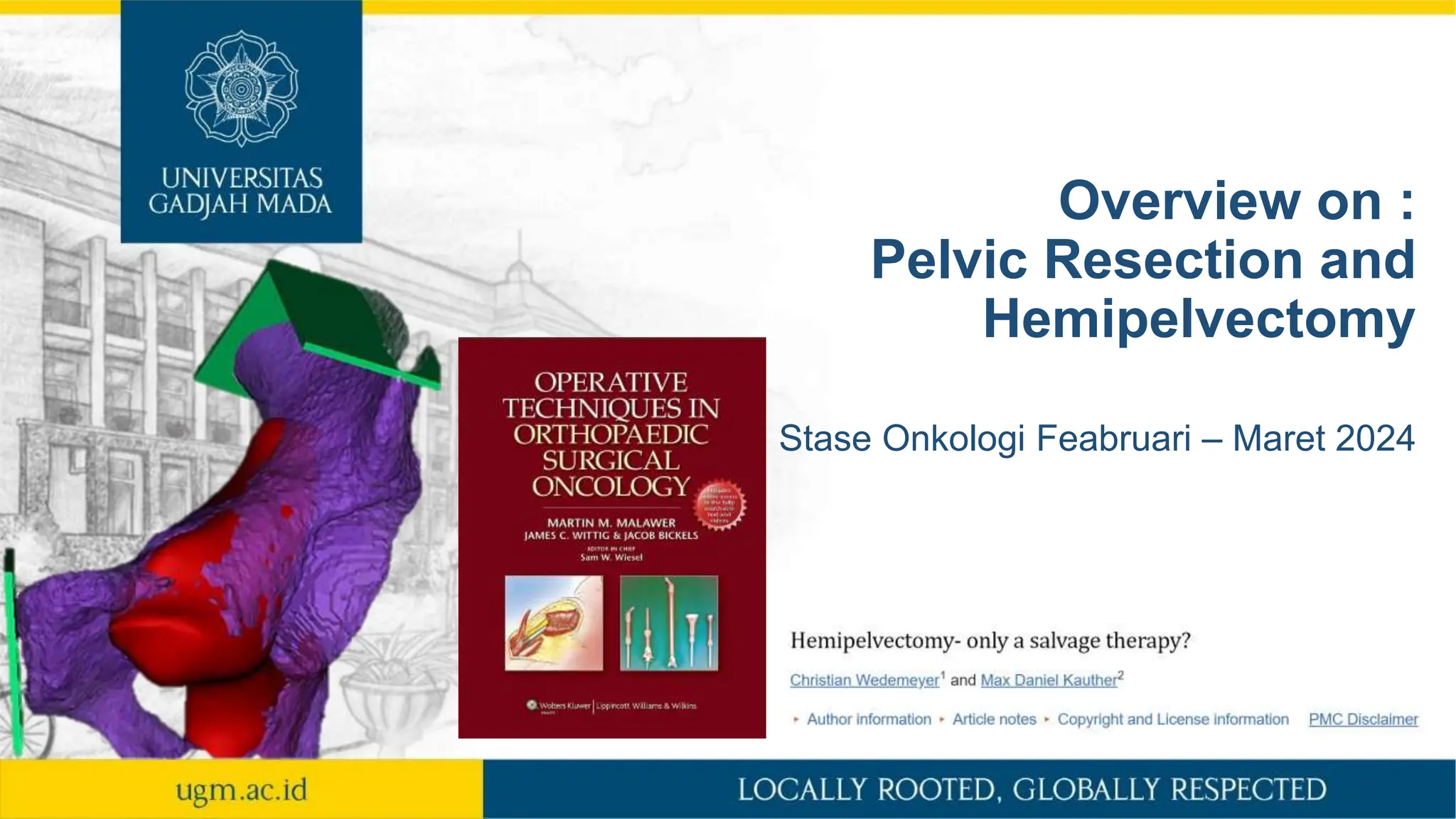 Malawer Pelvic Resection Pelvic resection by malawer book reading | PPTX