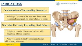 Malawer Pelvic Resection Pelvic resection by malawer book reading | PPTX