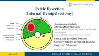 Malawer Pelvic Resection Pelvic resection by malawer book reading | PPTX