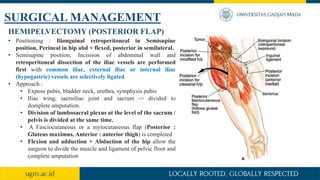 Malawer Pelvic Resection Pelvic resection by malawer book reading | PPTX