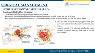Malawer Pelvic Resection Pelvic resection by malawer book reading | PPTX