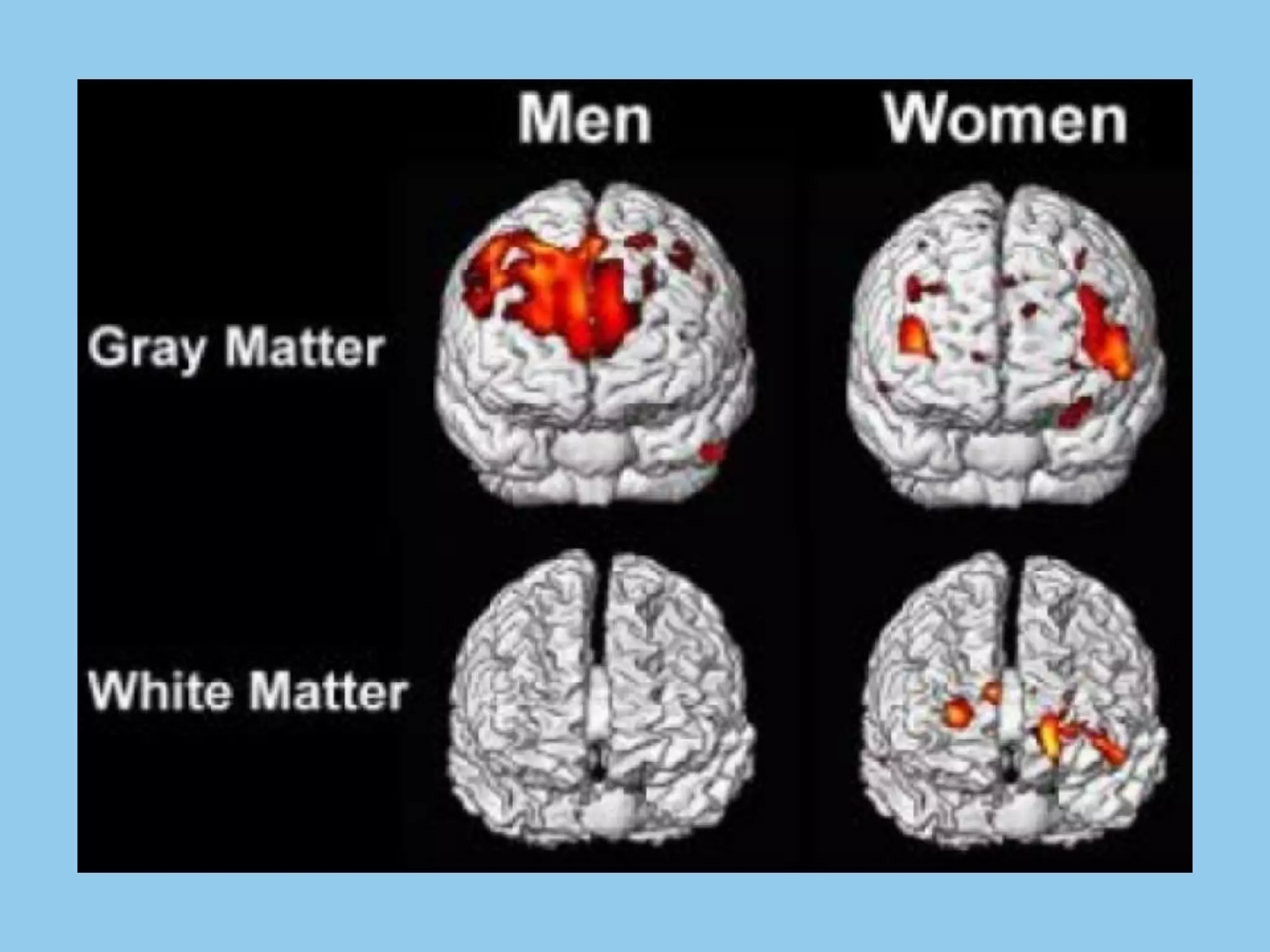 Male Female Brain Ppt