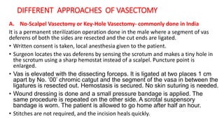 male contraception.pptx