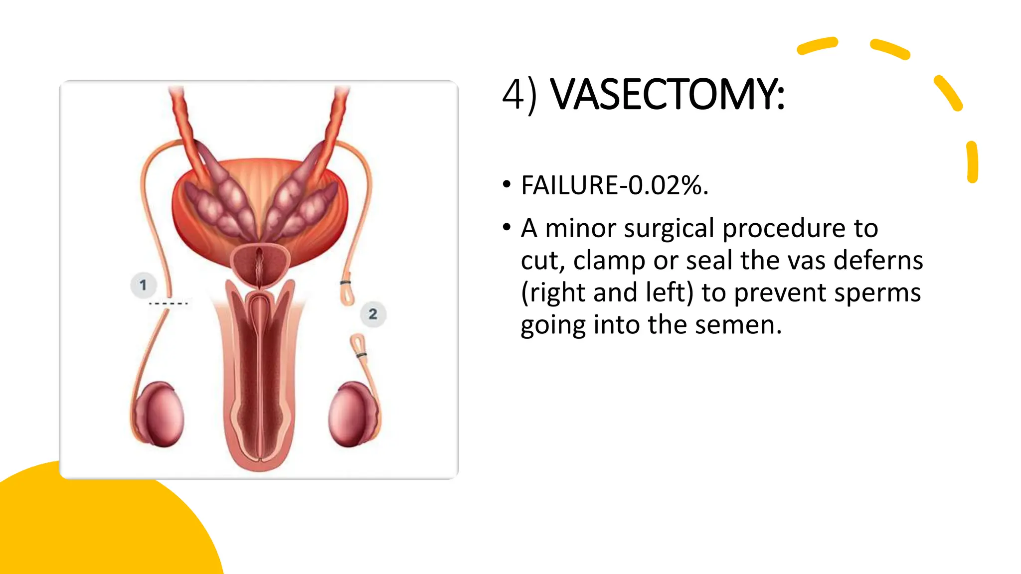male contraception- powerpoint presentation | PPTX