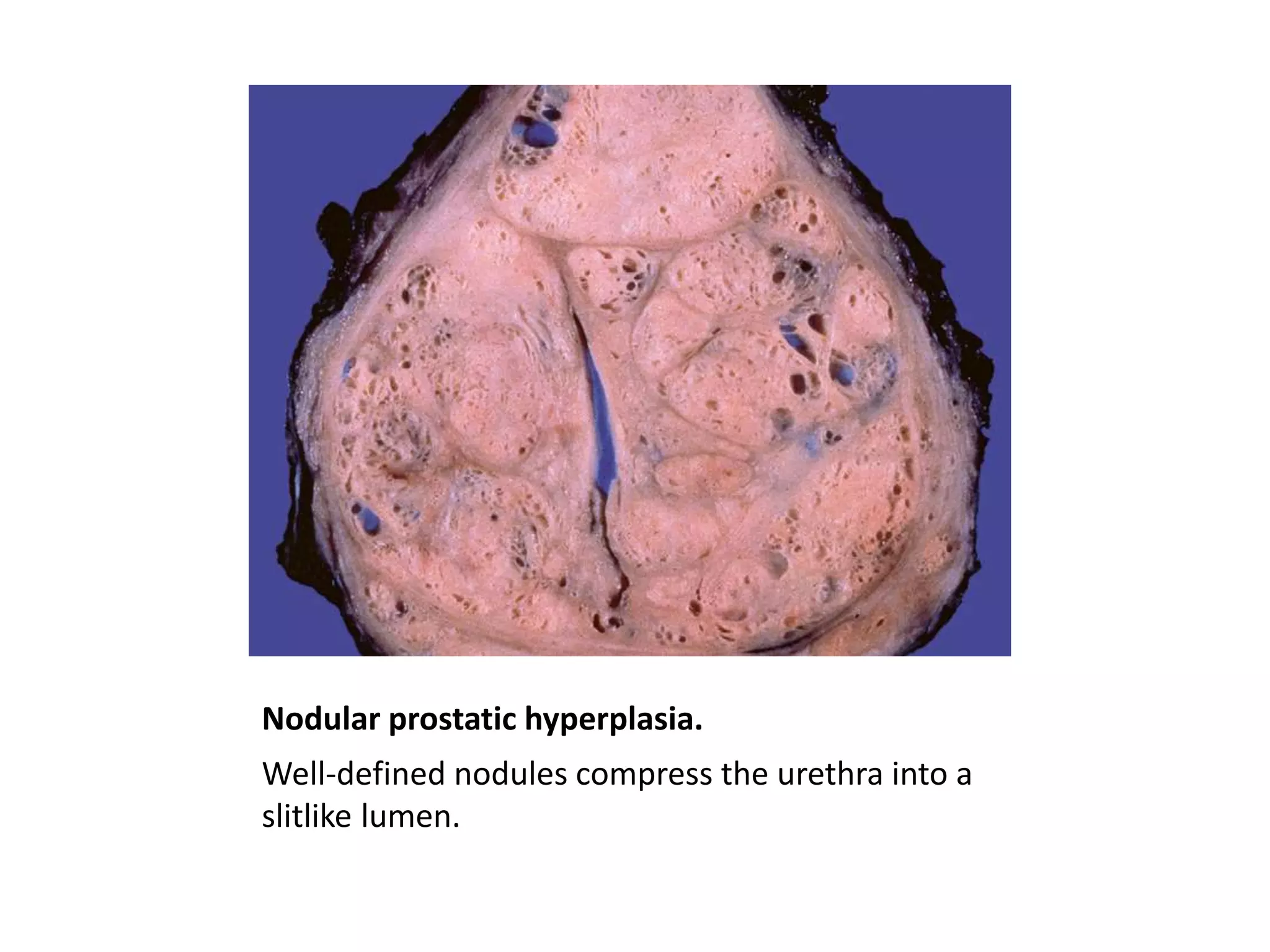 Male genital 3 | PPTX