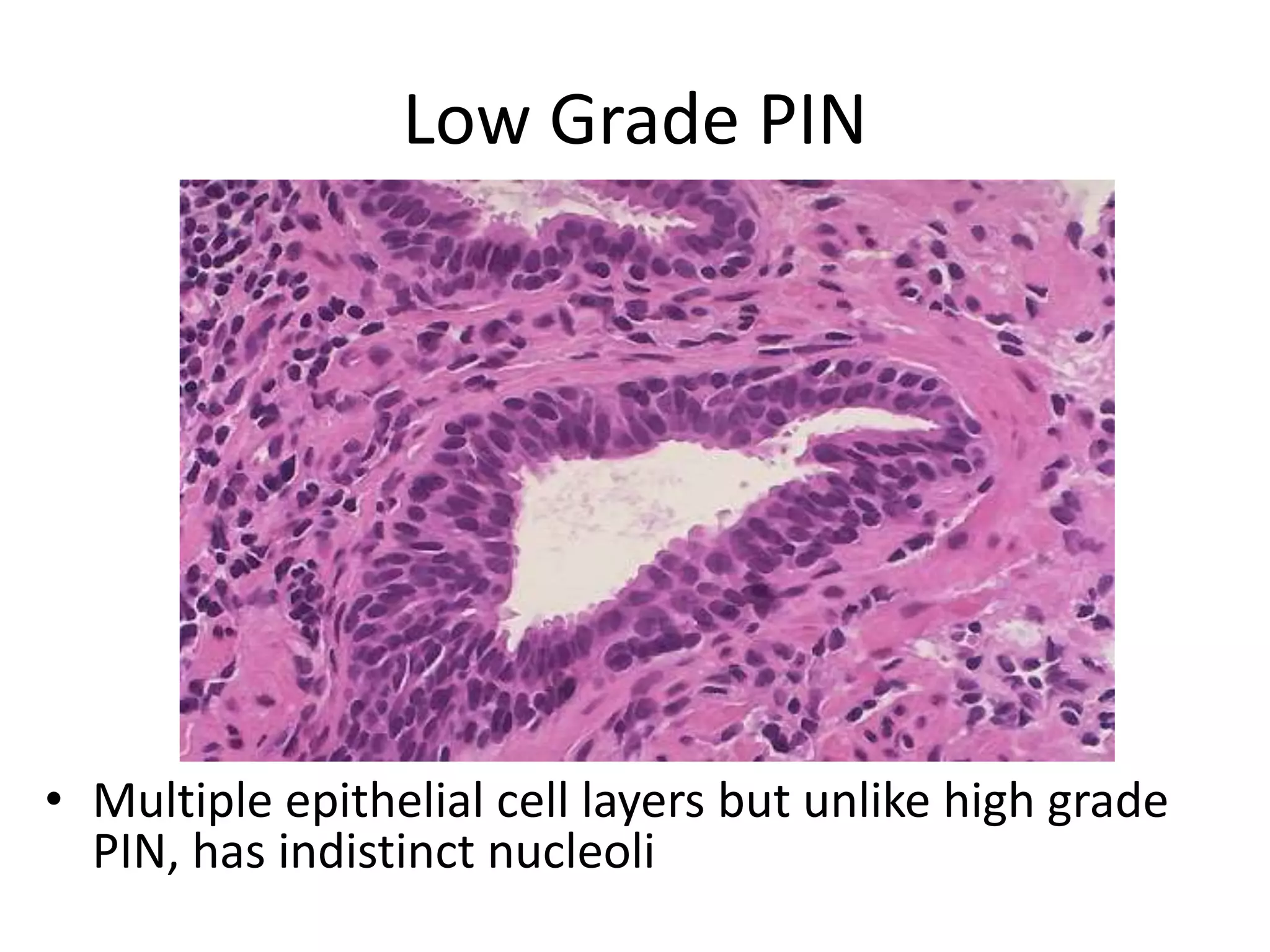 Male genital 3 | PPTX