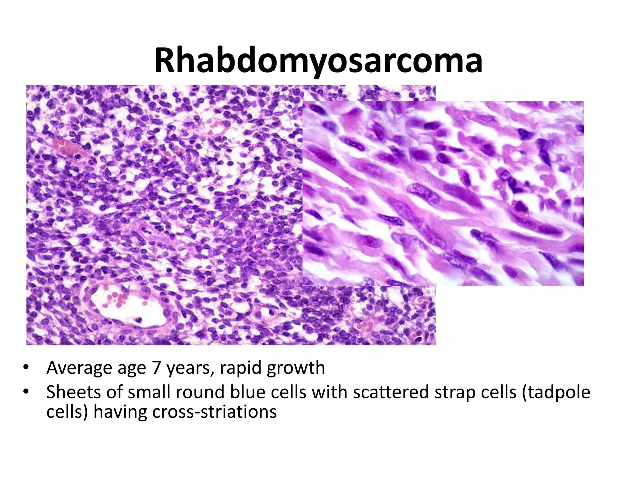 Male genital 3 | PPTX