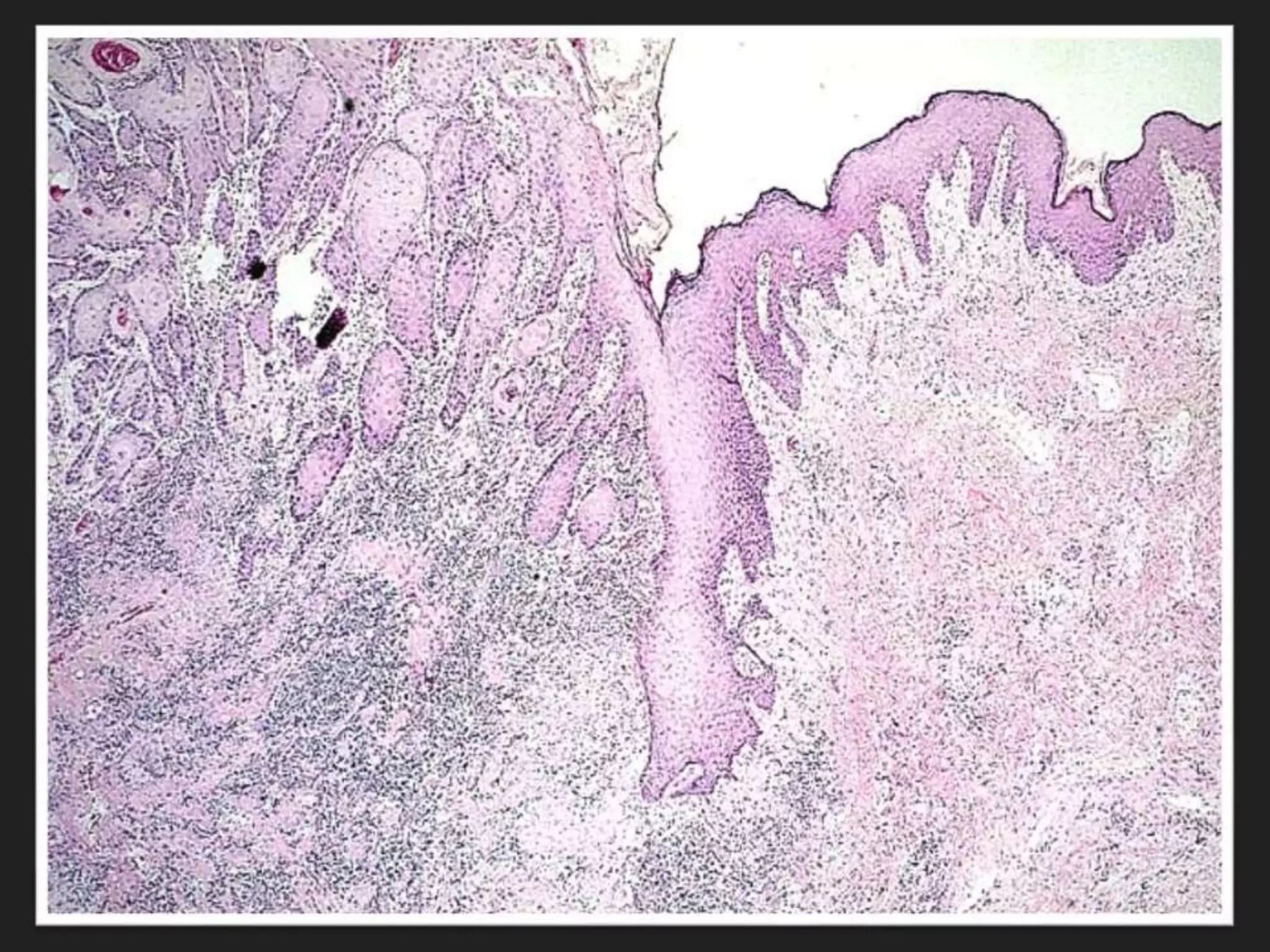 Pathology of Lower Urinary Tract & Male Genital System | PDF