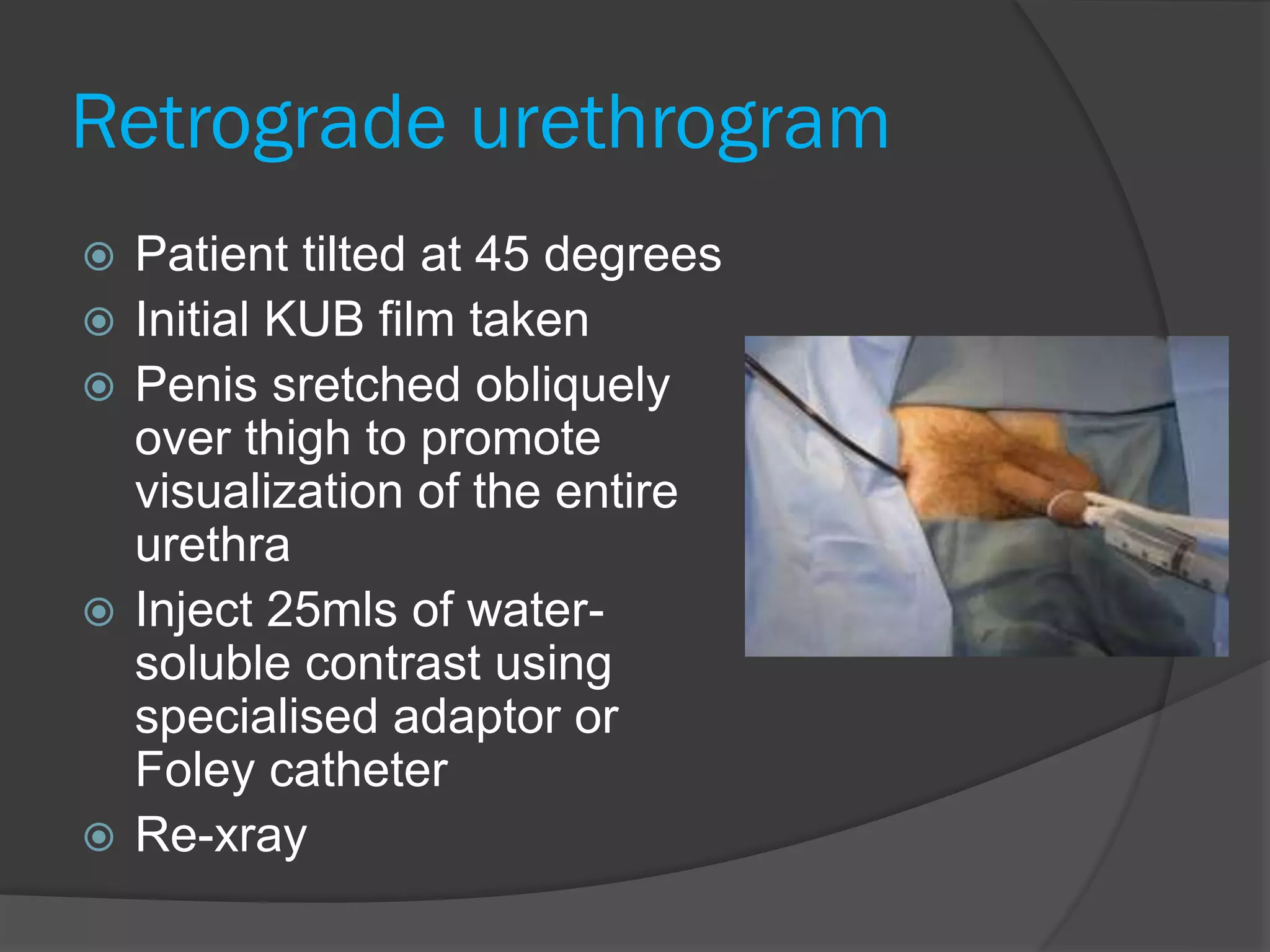 Male genital trauma | PPTX