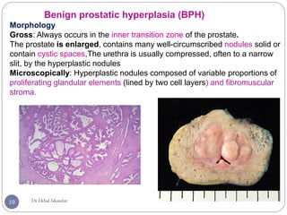 male gental tract & lower urinary tract.pdf