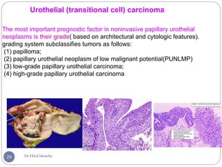 male gental tract & lower urinary tract.pdf