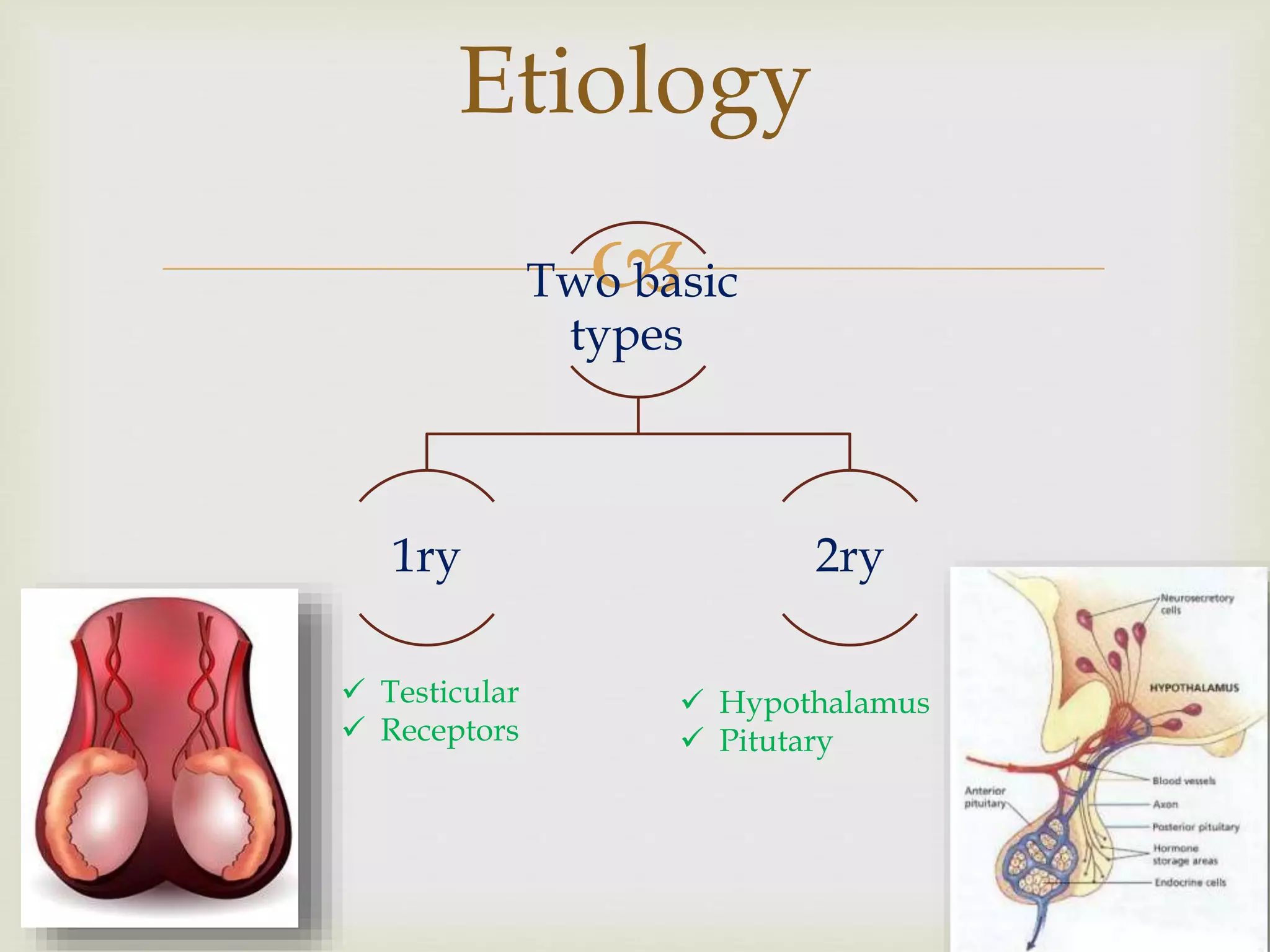 Male hypogonadism | PPTX