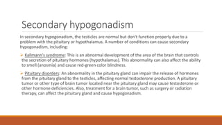 Male hypogonadism | PPTX